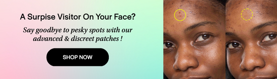 Best Pimple Patches UK: Superdots Spot Patches