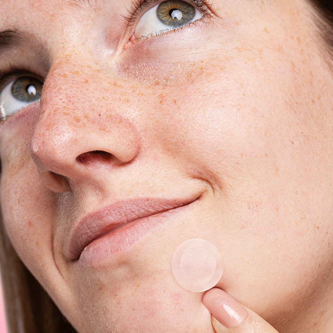 Best Pimple Patches UK: Superdots Spot Patches